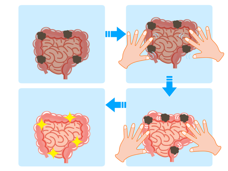 腸活で美しく！ | 高松市 モミグリデイスパ(MOMIGURI DAY SPA)